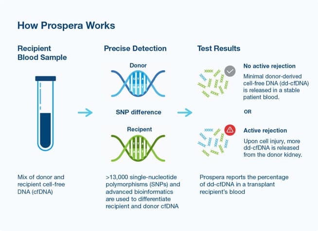 Prospera Overview | Cell-Free DNA Testing | Natera