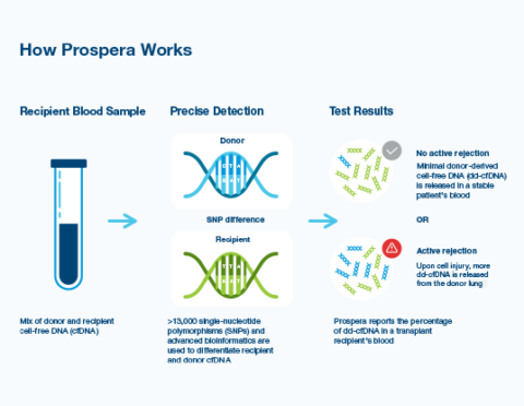 Prospera Lung Overview | Cell-Free DNA Testing | Natera