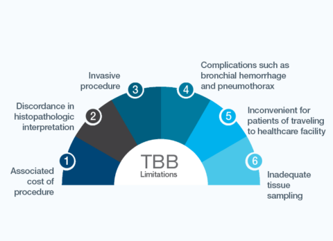 Prospera Lung Overview | Cell-Free DNA Testing | Natera