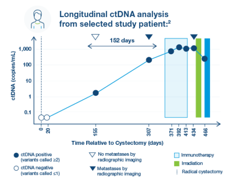 Bladder Cancer | Natera