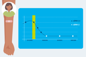 Breast Cancer Recurrence Screening Blood Test – Signatera