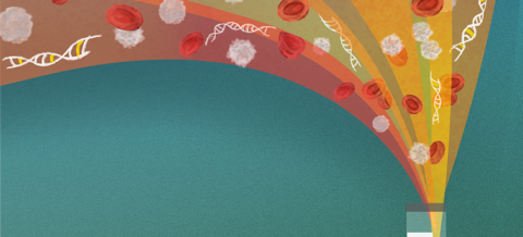 Natera: A global leader in cfDNA testing