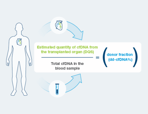 Prospera Heart Overview | Cell-Free DNA Testing | Natera