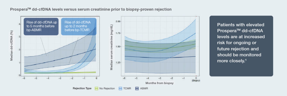 Transplant Rejection Assessment | Natera